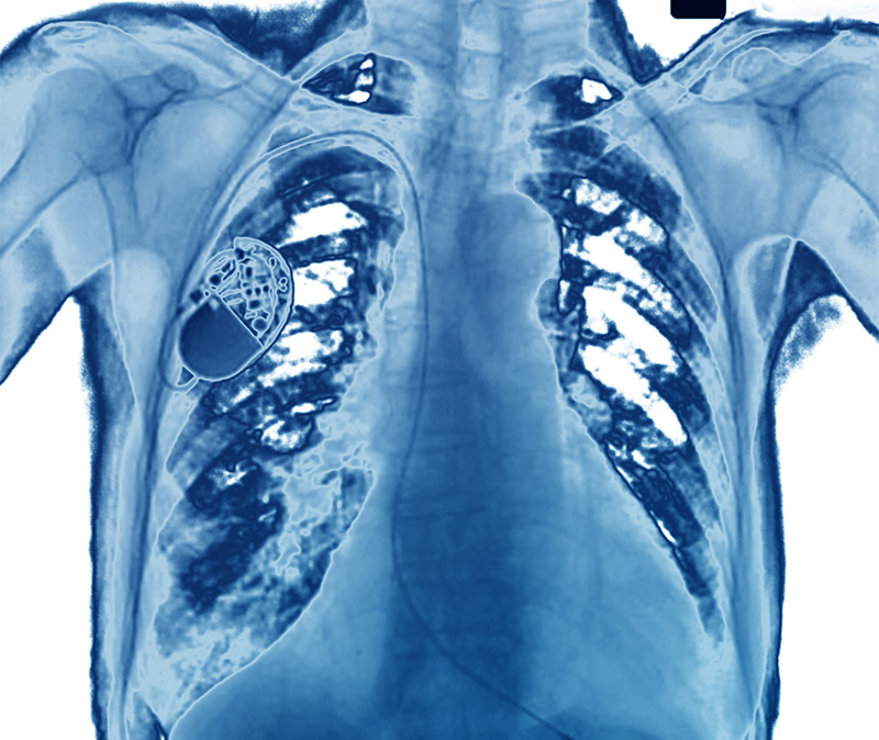 Medical Connectors and Product Applications